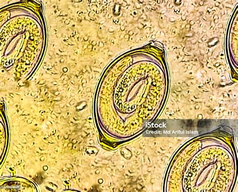 Embryonated Egg Of Trichuris Trichiura On An Iodinestained Wet Mount