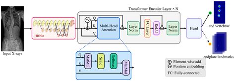 Bioengineering Free Full Text Spinehrformer A Transformer Based