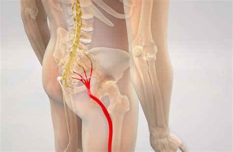 Sciatica Calf Pain Vs Dvt Pain Key Differences Scary Symptoms