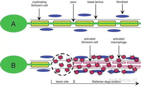 你了解神经损伤是如何恢复的吗？ 知乎