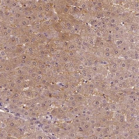 Rabbit Polyclonal Anti Nsd2 Antibody Buy For Research Highly