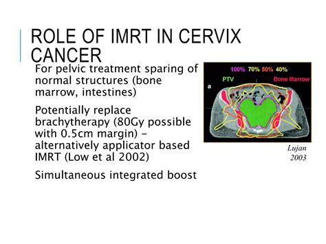 Ca Cervix Ppt