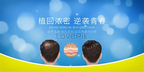 男人脫髮圖片素材 男人脫髮png背景圖案免費下載 Lovepik
