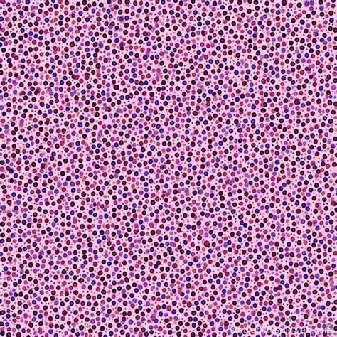 Tuberculosis Bacteria Pattern Stable Diffusion Online