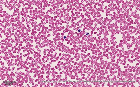 Micrograph Of Human Blood Smear Illustrating Red Blood Cells And Leukocytes
