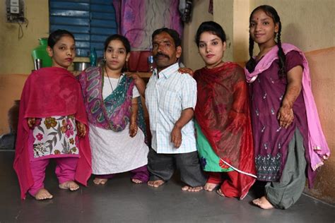 Todo Lo Que Debe Saber De La Acondroplasia Más Allá De La Talla Baja