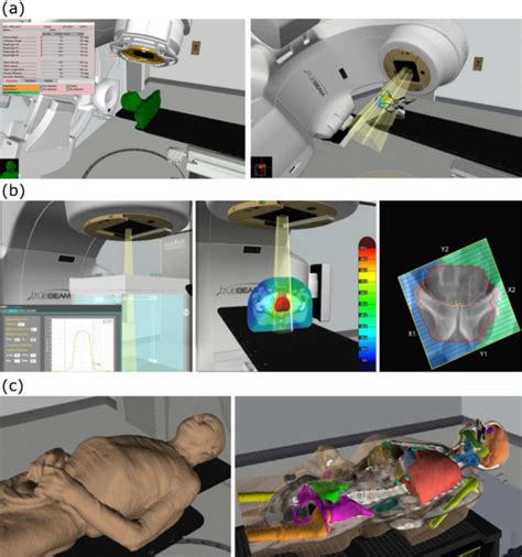 Figure 2 From Application Of Virtual Environment For Radiotherapy