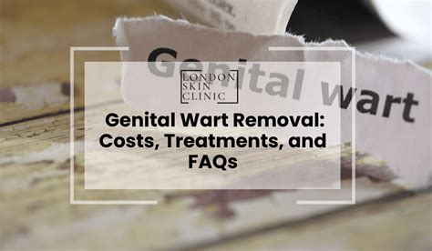 Genital Wart Removal London Costs Methods And Discreet Care
