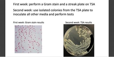 Staphylococcus Epidermidis Streak Plate