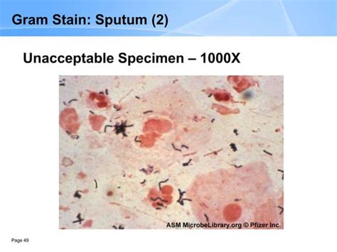 Specimen Processingppt