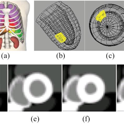4d Ncat Model With A Beating Heart Anterior View Of The 4d Ncat Download Scientific Diagram