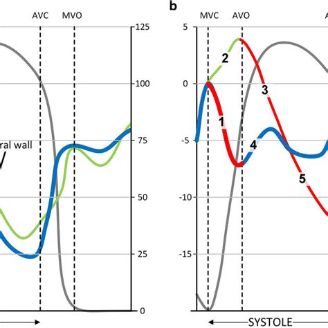 Septal And Postero Lateral Wall Strain Patterns In Lbbb And Impact Of
