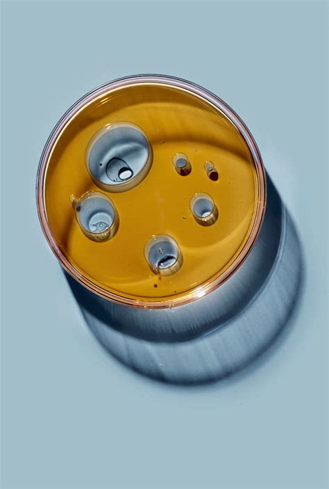 Prose Beauty — Alison Attenborough