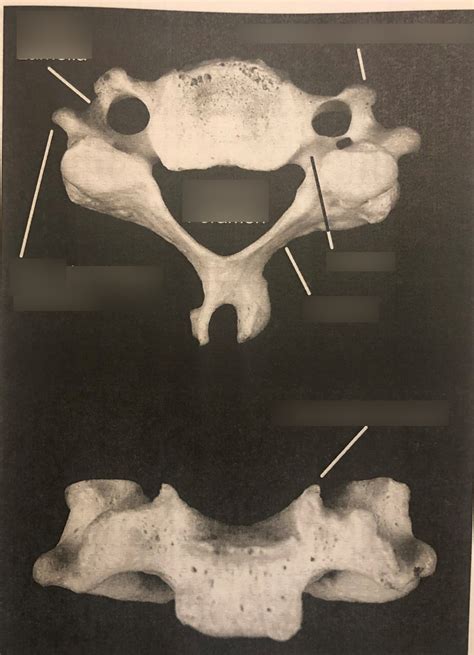 Lab 1 Cnt Typical Cervical Vertebra Diagram Quizlet