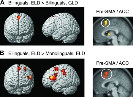 Bilingual Brain Vs Monolingual Brain