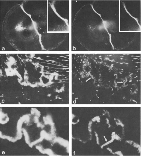 A And B Large Adhesion Junction Between Two Neighboring Cells