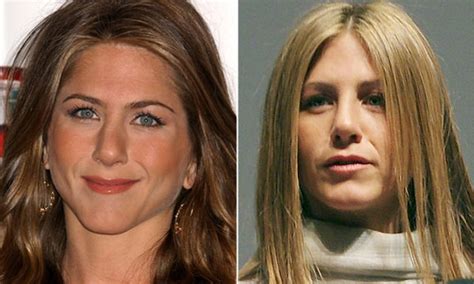 10 Celebridades Que Se Realizaron Una Rinoplastia Antes Y Después