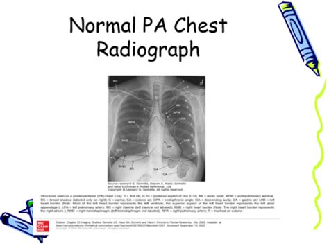 Chest Abnormalities Flashcards Quizlet
