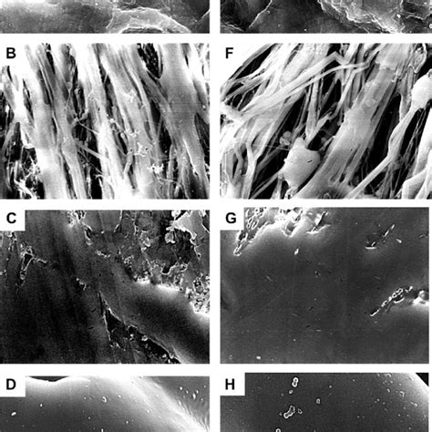 Adhesion Of Streptococcus Mutans On Various Guided Tissue Regeneration Download Scientific