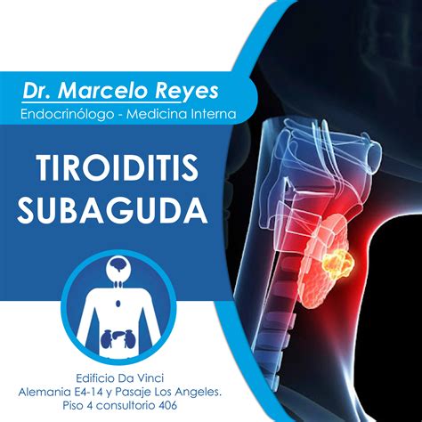 La Tiroiditis Subaguda Dr Marcelo Reyes Endocrinólogo
