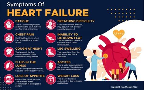Symptoms Of Heart Failure Heart Failure Guide For Patients