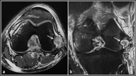 Imaging Review Of Normal Anatomy And Pathological Conditions Involving