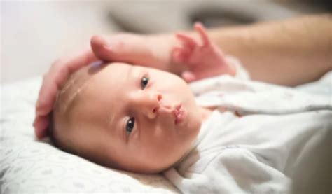 Caspa No Bebê Como Prevenir E Tratar Instituto Villamil