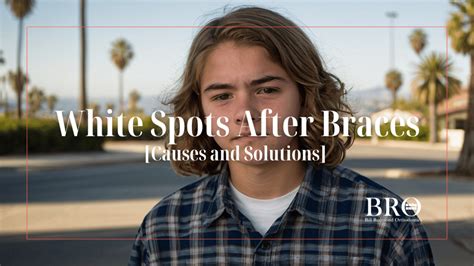 White Spots After Braces Causes And Solutions Gotobro