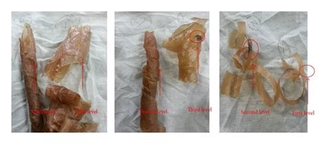 After Poking Iron Cores Lead Insulation Of Column A Download