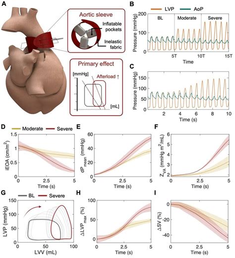 Hemodynamic Effects Of The Soft Robotic Aortic Sleeve For In Vivo Model