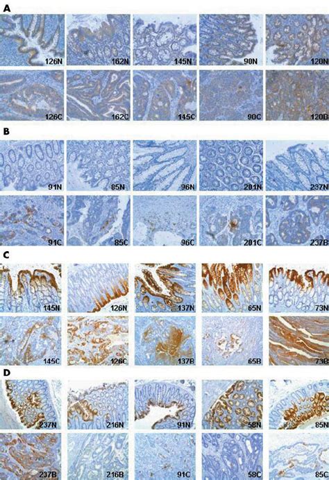 Immunohistochemistry Of Formalin Fixed Paraffin Embedded Sections Of