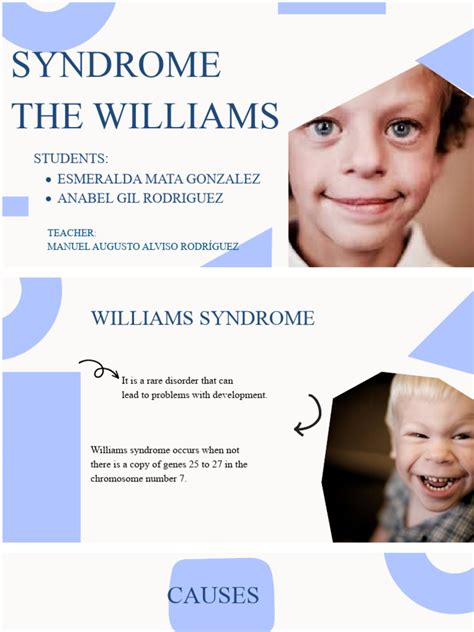 Understanding Williams Syndrome Causes And Symptoms Pdf Human