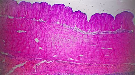 Transversal Section Of Large Intestinal Under Microscope 40x For Educational Issues On Bright