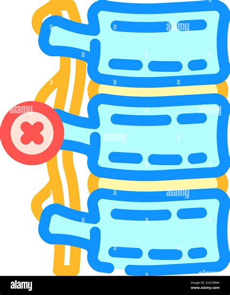 Sympathectomy Color Icon Vector Illustration Stock Vector Image And Art