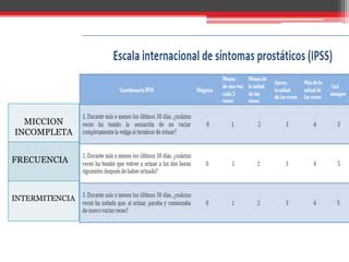 Hiperplasia Prostática Benigna Pptx