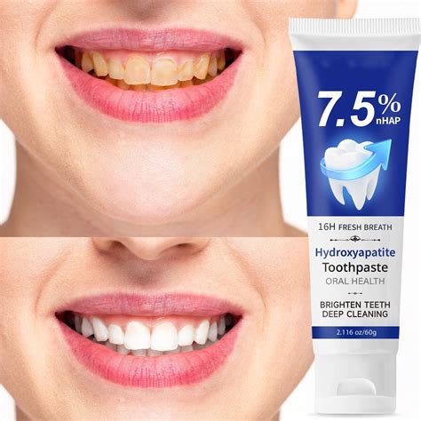 Gentle Teeth Cleaning Toothpaste With Advanced Stain Removal And