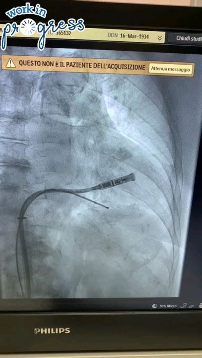 Simone Persampieri On Linkedin What Else Dbarnne