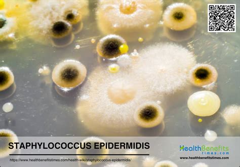 What Is Staphylococcus Epidermidis And Its Role In Skin Health Health Benefits