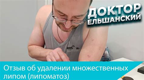 Отзыв. Липоматоз, удаление множественных липом - YouTube