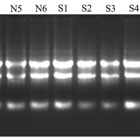 Denaturing Agarose Gel Electrophoresis Of Total Rna Extracted From The