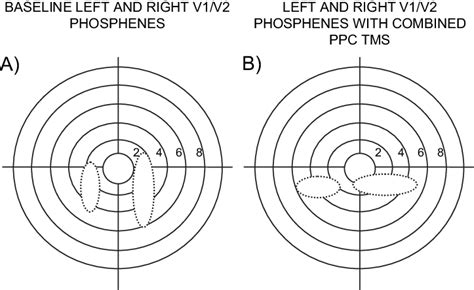 Examples Of Phosphenes Induced From V1v2 In The Right And Left