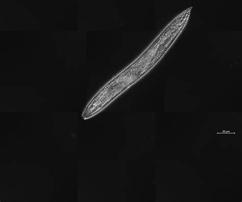 Nematodes Of Pennsylvania — About The Department — Department Of Plant Pathology And
