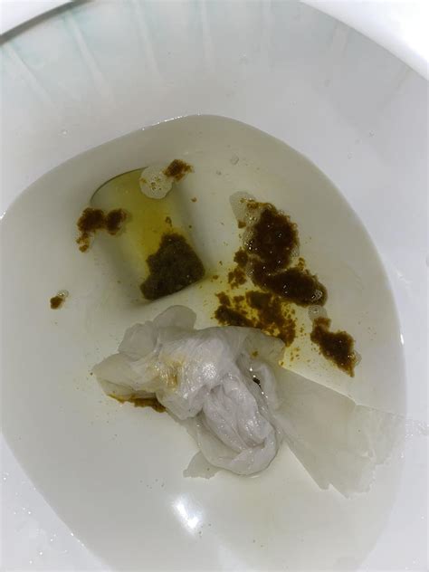 Is This Cdiff Ive Had Diarrhea For Like 2 Days And Im Thinking Food