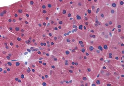 Anti Mda5 Antibody Rabbit Polyclonal Ab79055 Abcam