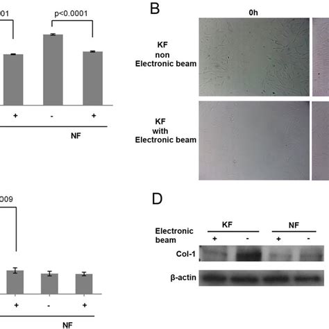 Electron Beam Irradiation Had Negative Effects On The Proliferation