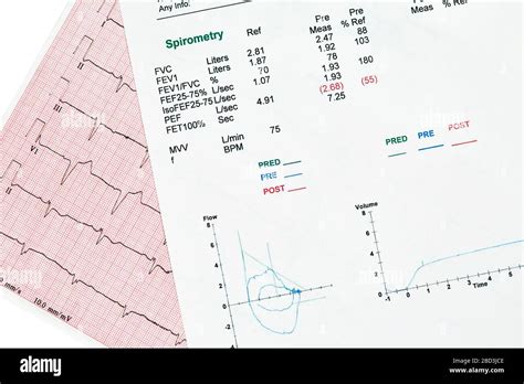 Spirometry Sample Report At Nichelle Hock Blog