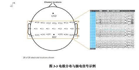基于运动想象脑机接口的上肢外骨骼康复系统研究 知乎
