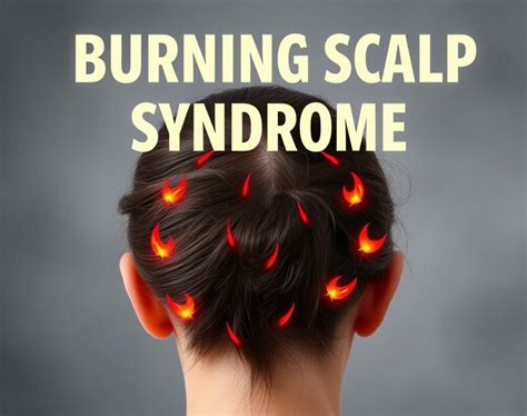 Burning Scalp Syndrome Explained Symptoms Causes And Treatment Options