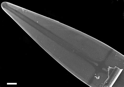Image Stauroneis Baileyi Sem1 Ansp Gcm3785 78 039  Species Diatoms Of North America