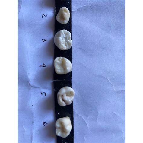 Jual Mahkota Gigi Susu Gigi Decidui Gigi Desidui Gigi Praktikum Shopee Indonesia